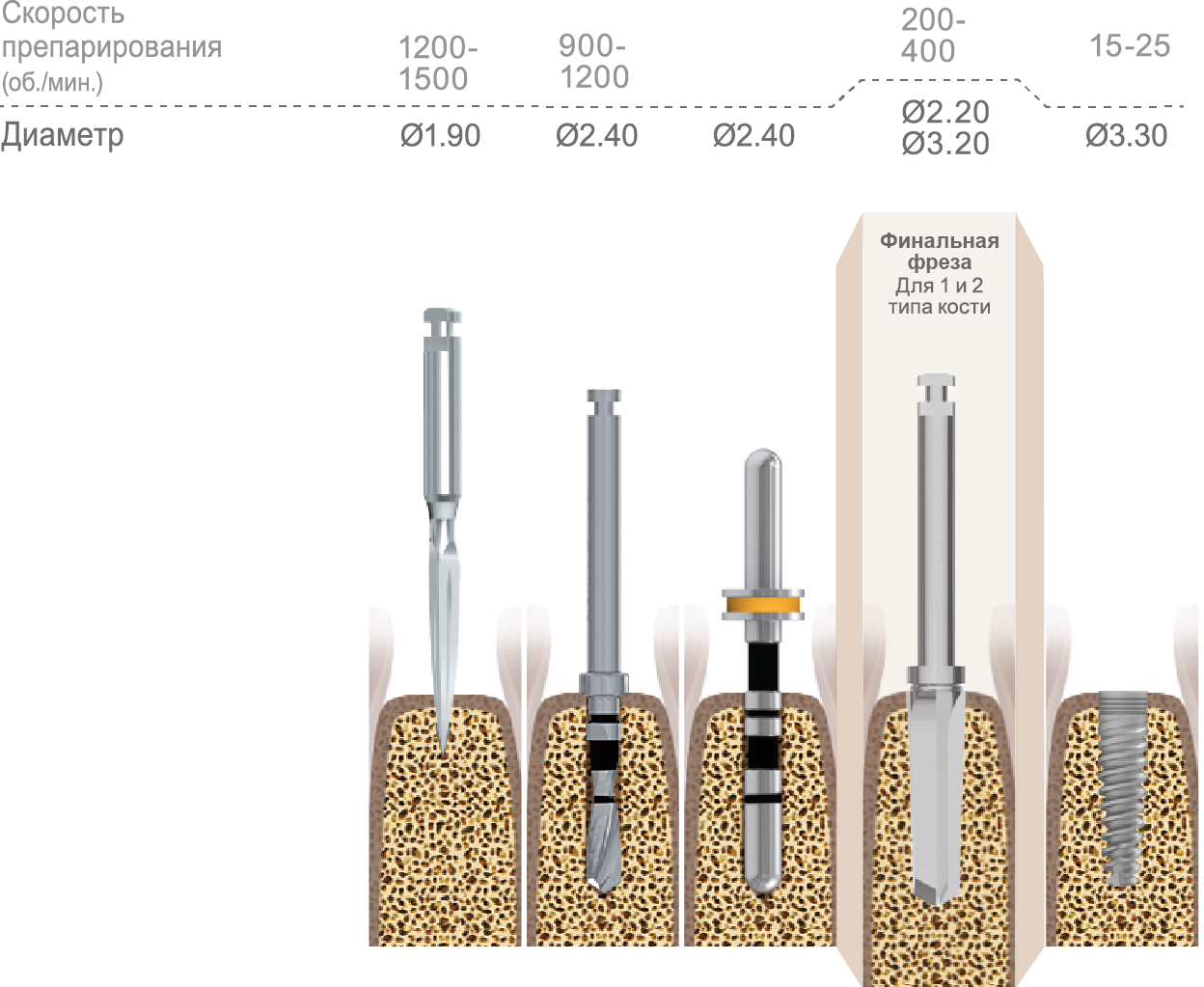 MIS SEVEN - имплантат с шестигранным соединением | Mis Implants Russia